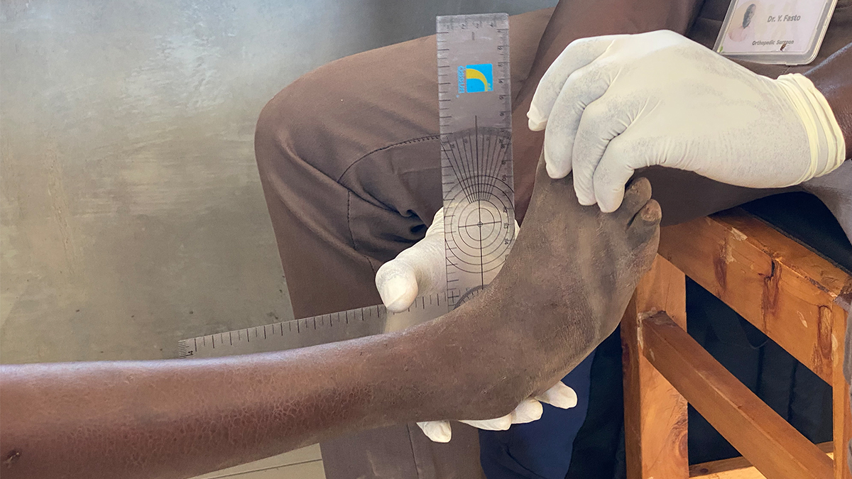 MAF flies orthopaedic doctors to treat disabilities in remotest Kenya ...